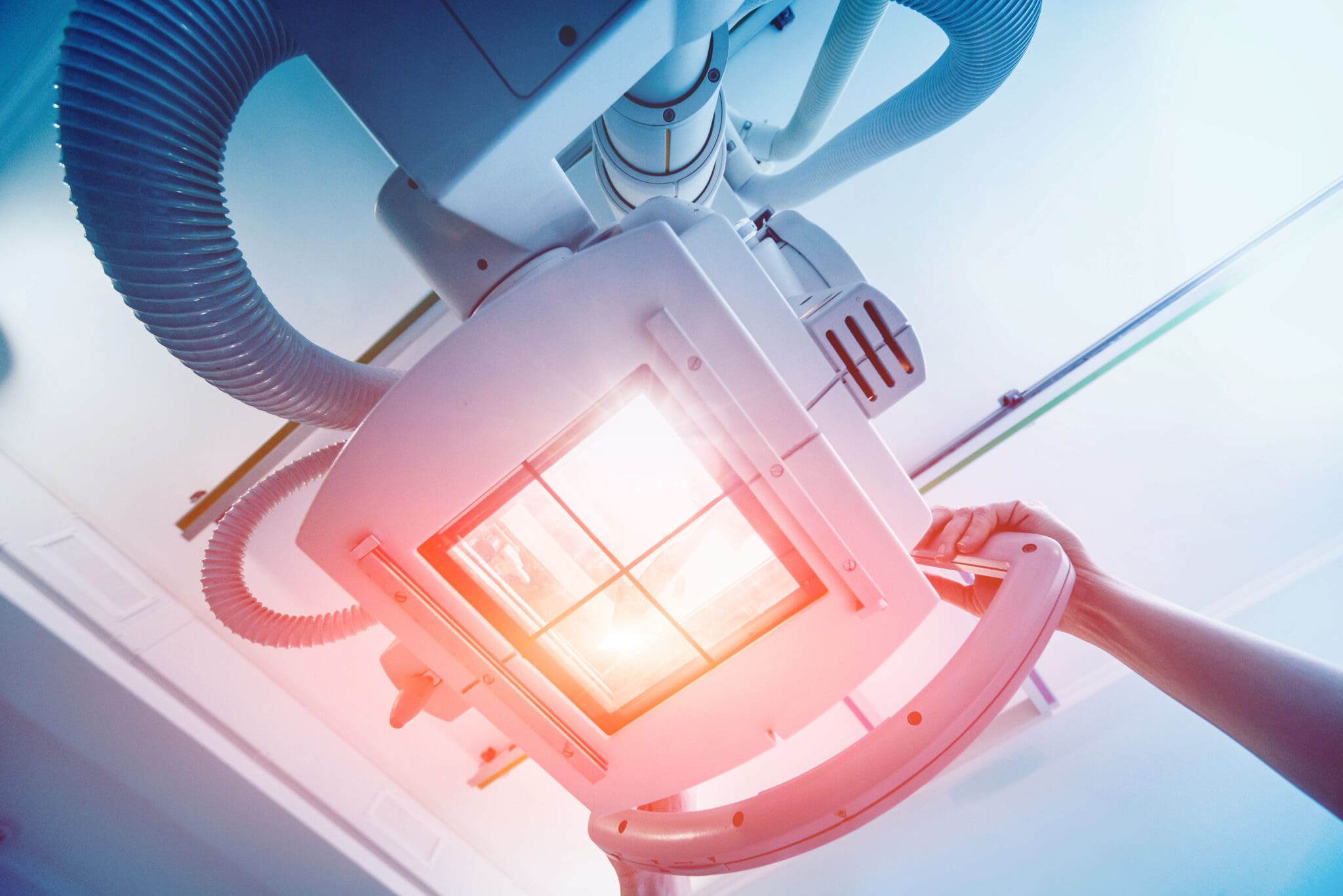 What Is X-ray Irradiation? | Pulstec USA